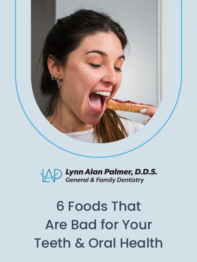 6 Foods That Are Bad for Your Teeth & Oral Health | Lynn Palmer DDS